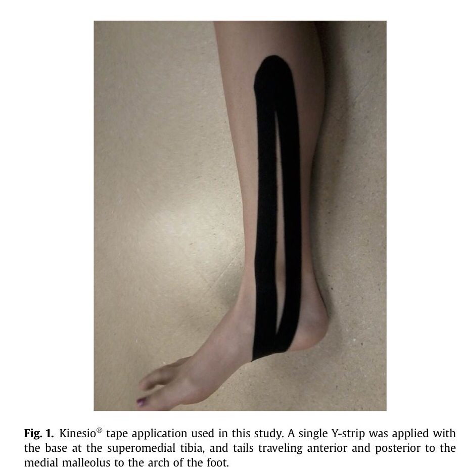 Shin Pain - RunningPhysio