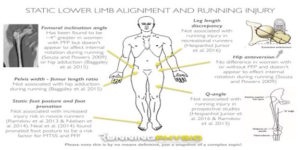 Static alignment in runners, are we moving forward by standing still ...