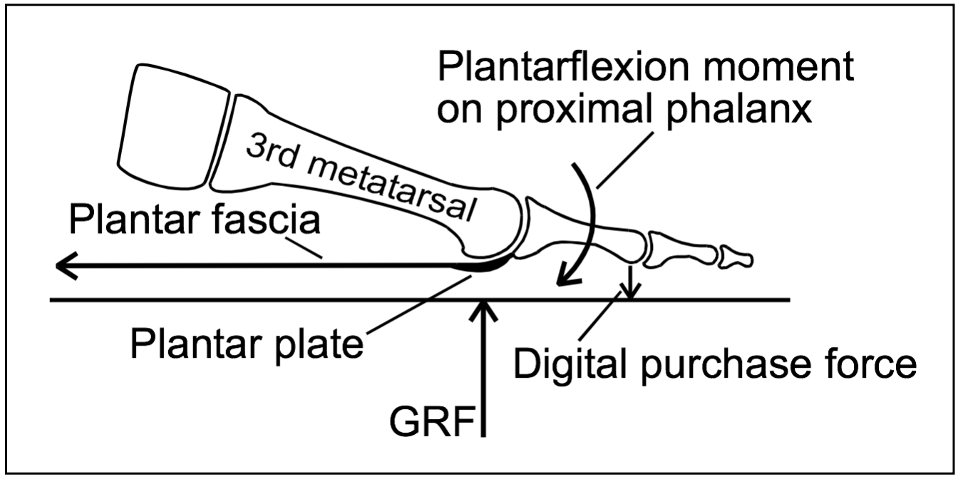 Plantar Plate injury, assessment and management - by Nick Knight ...