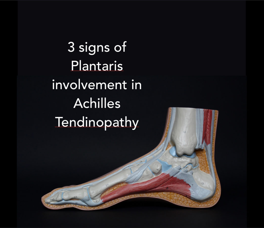 Running Injuries | RunningPhysio