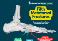 Is stress slowing down your running? - RunningPhysio