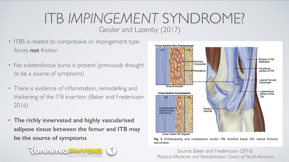 Why you need a tight ITB! - RunningPhysio